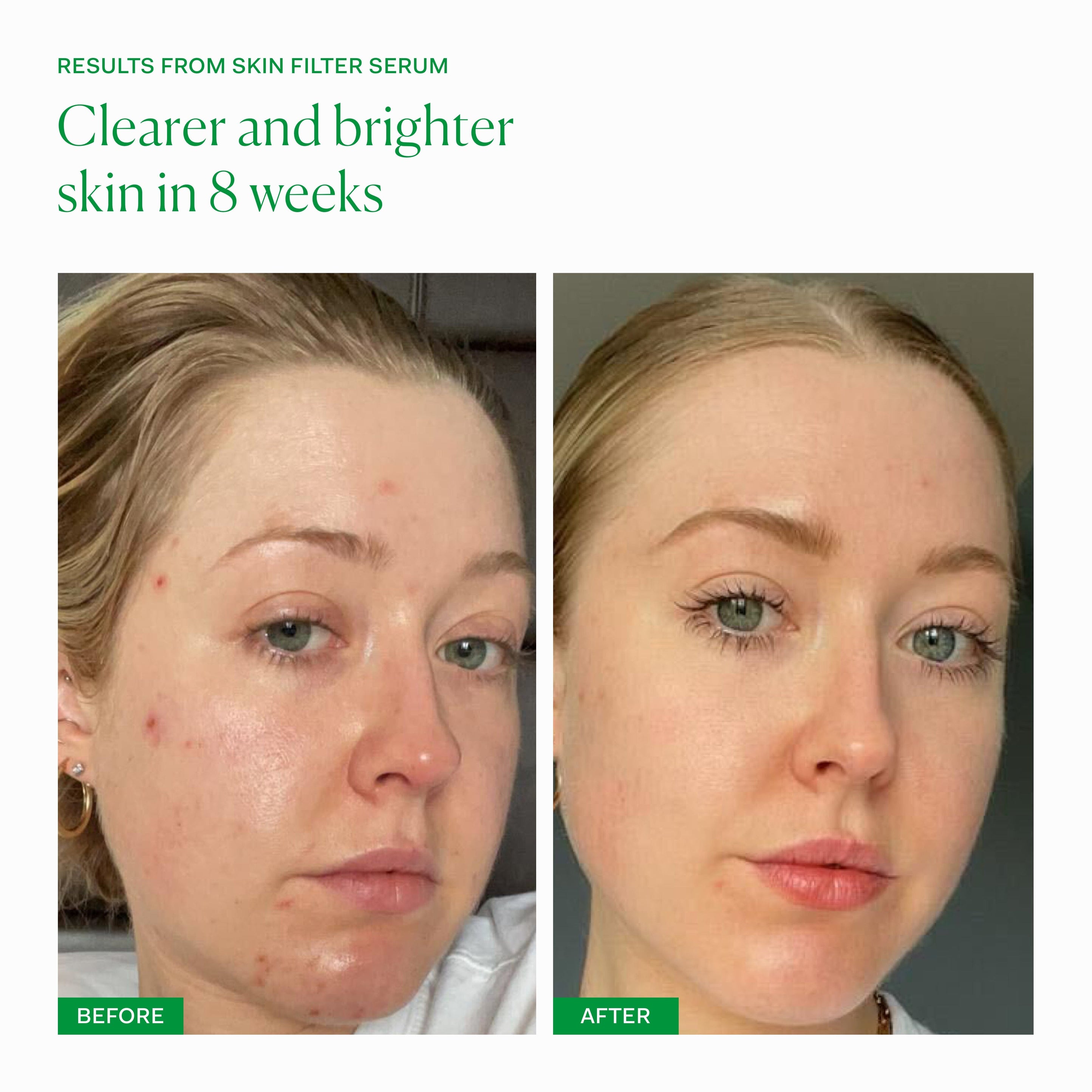 SKIN FILTER SERUM | Natural Retinol Skincare | The Nue Co. – The Nue Co.